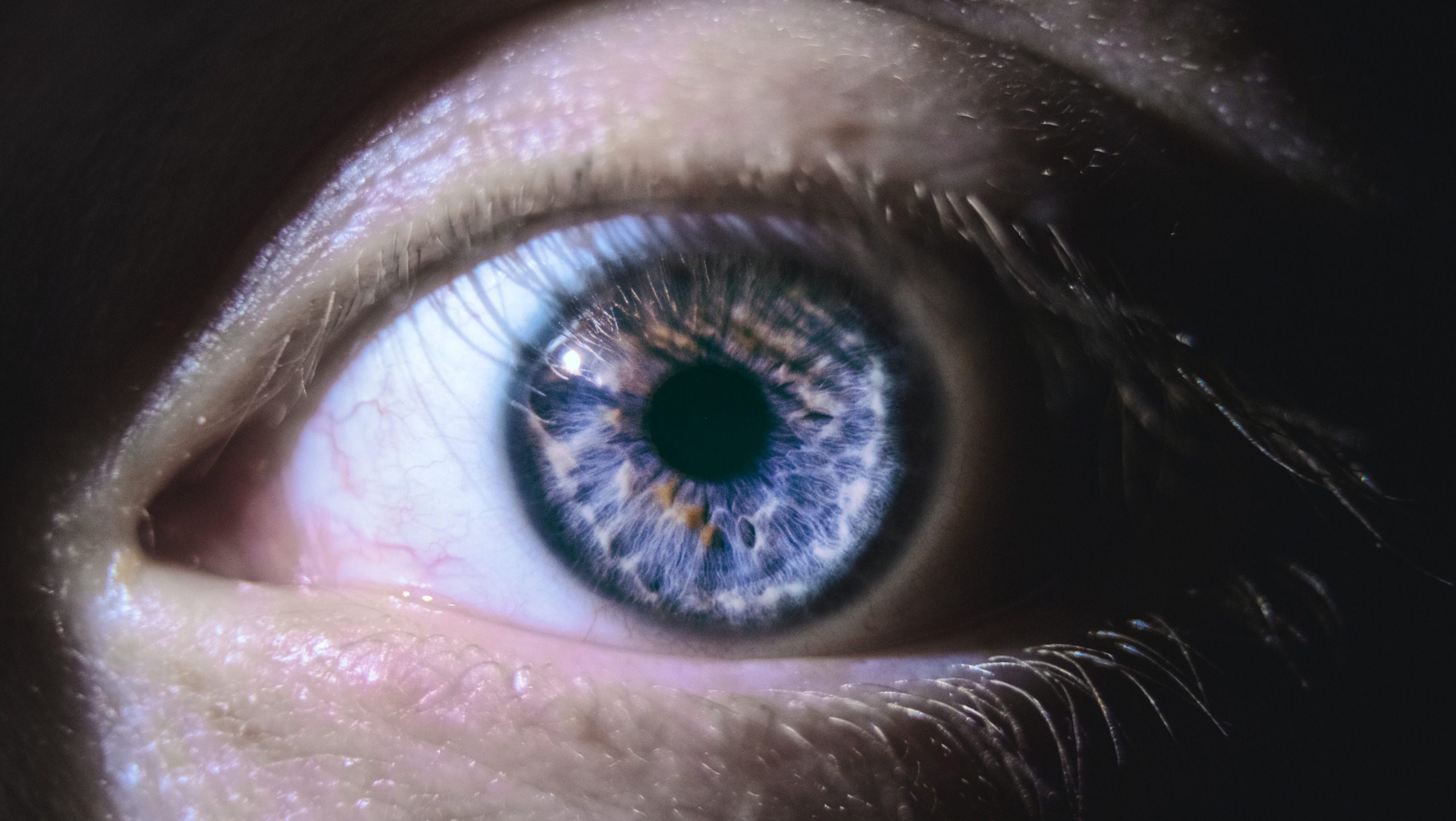 Neuromyelitis optica (NMO) | Scleroseforeningen