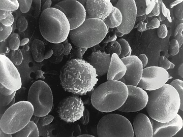 Behandling af sclerose | Scleroseforeningen